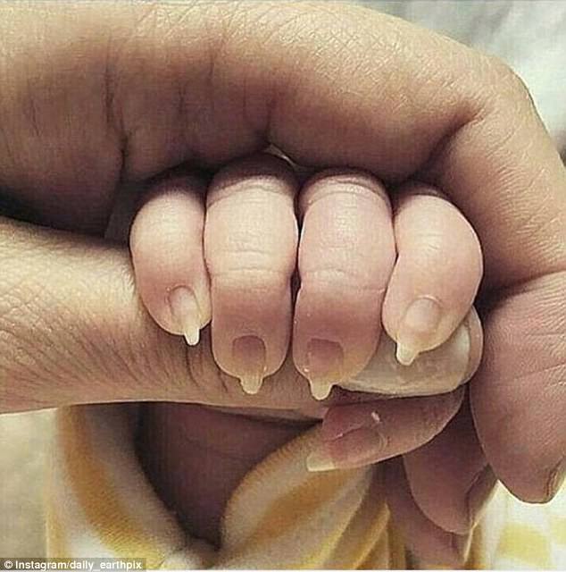 صورة يدّ رضيع تثير ضجة كبيرة على انستغرام - Lebanon News