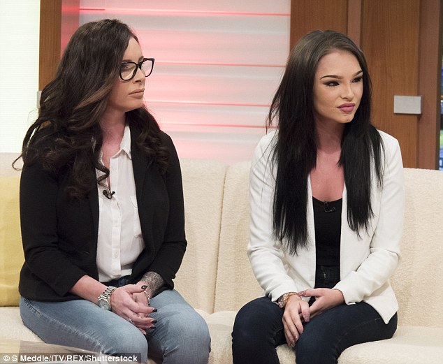 بالصور: شابة تسترجع وجهها بعد 8 سنوات من المعاناة - Lebanon News